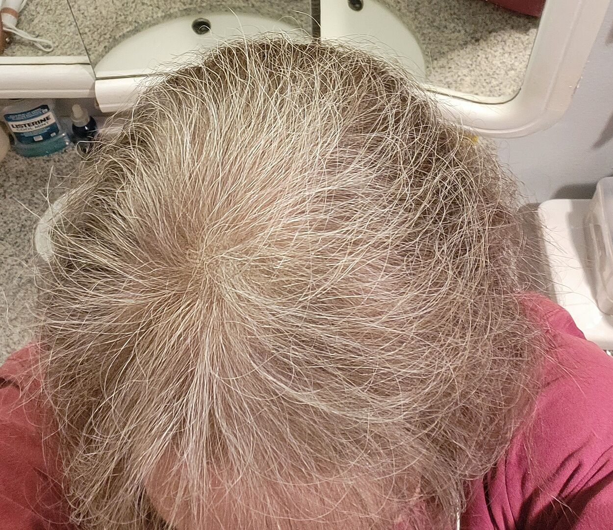 Reviews On Hair Building Fibers – Caboki.com